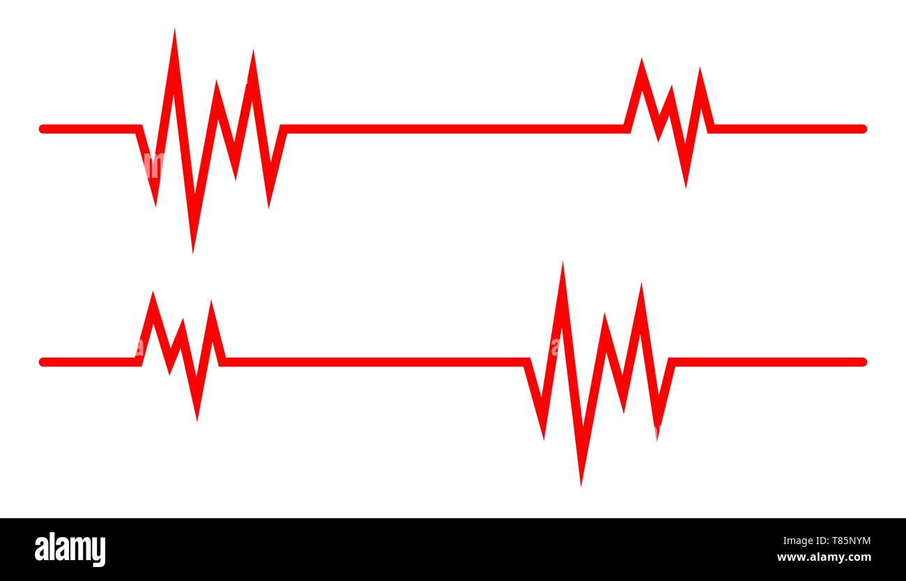 Electrocardiogramme plat Banque de photographies et d’images à haute ...