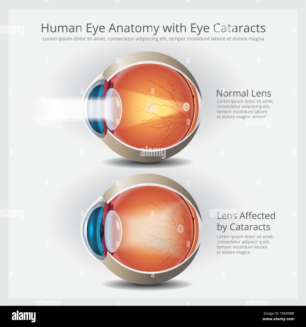 Anatomie de l'Œil humain Vector Illustration Image Vectorielle Stock ...