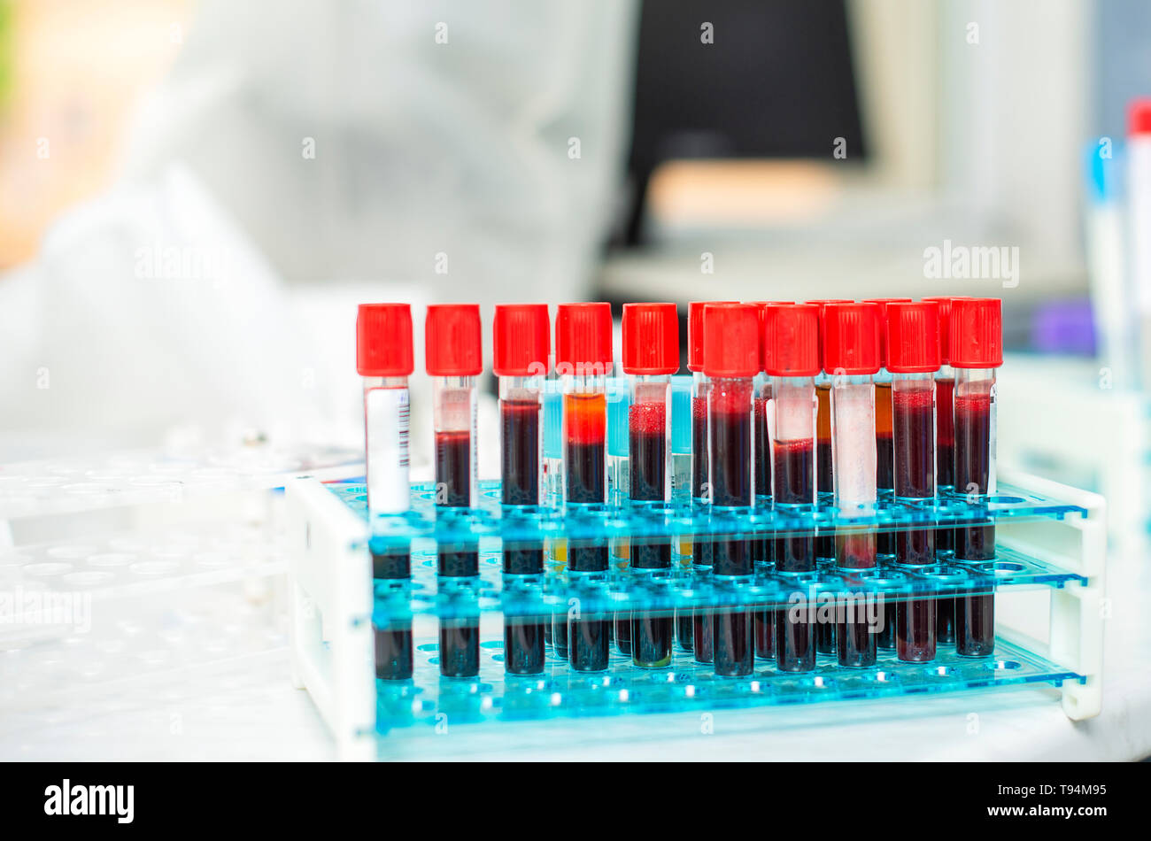 Erythrocyte sedimentation rate Banque de photographies et d’images à ...