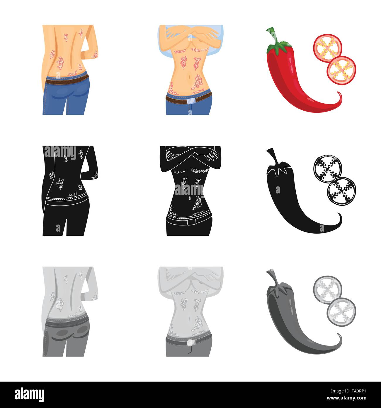 Psoriasis Back Banque Dimages Vectorielles Alamy