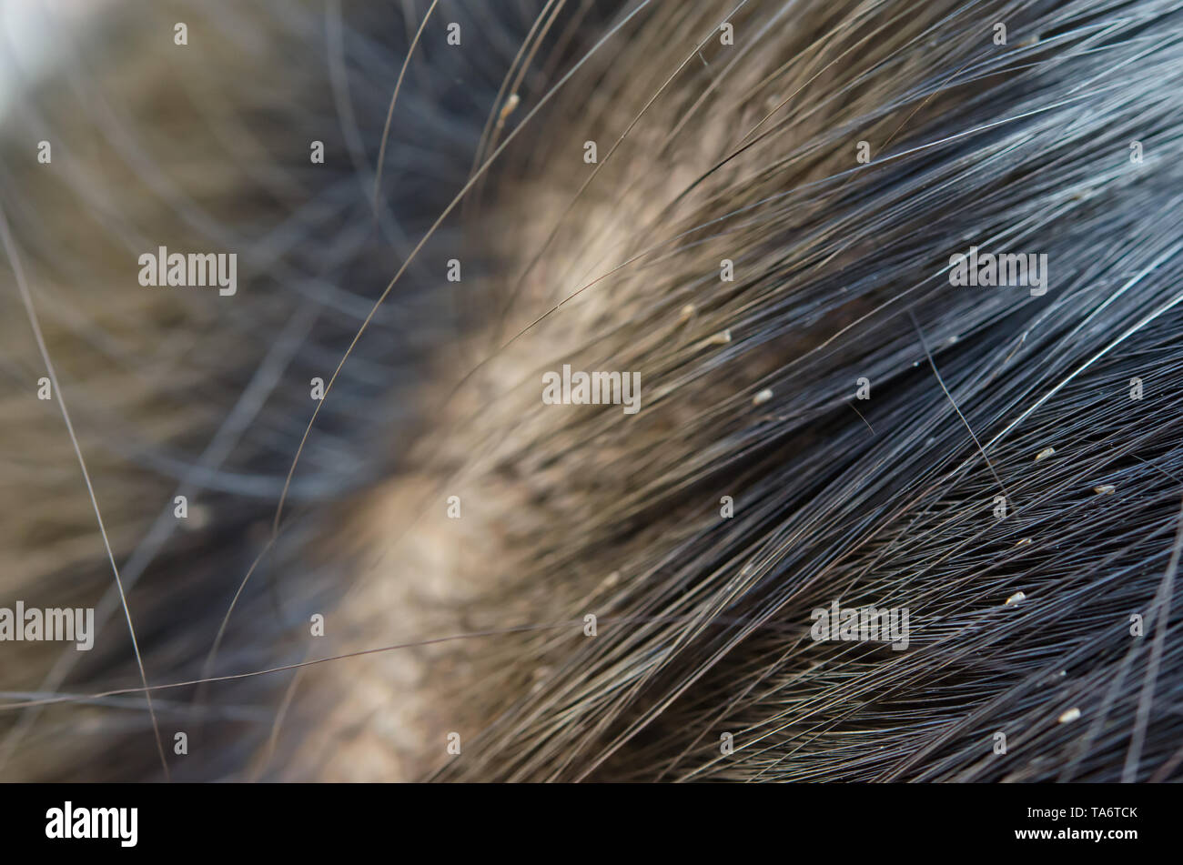 œufs de poux Banque de photographies et d’images à haute résolution - Alamy