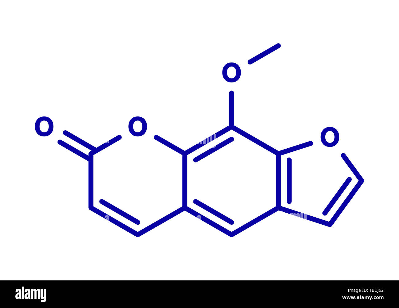 Lymphoma skin Banque de photographies et d’images à haute résolution ...