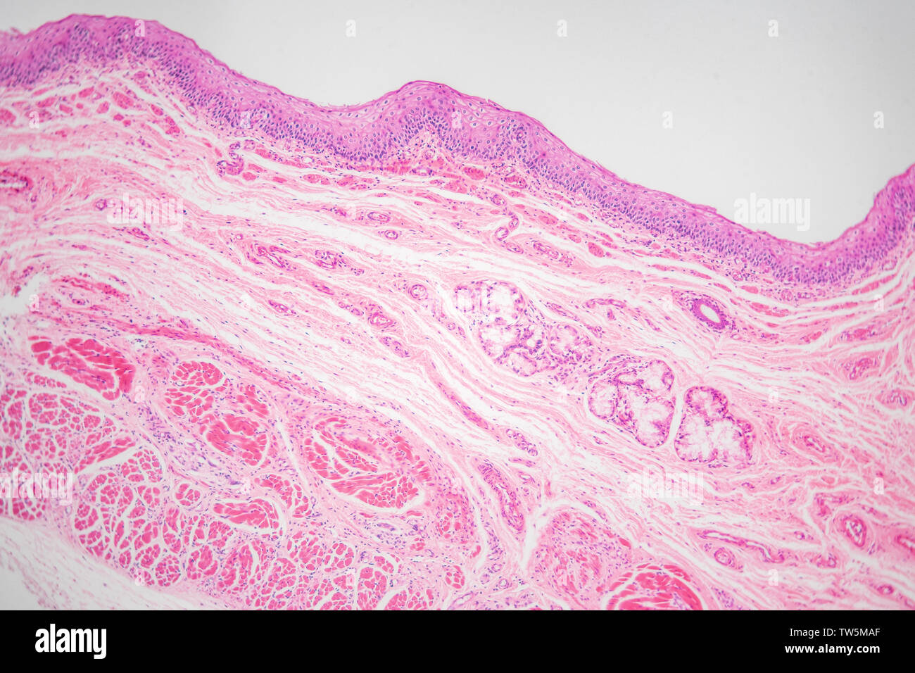 La section longitudinale des droits de l'oesophage, 100 fois magnifiée ...