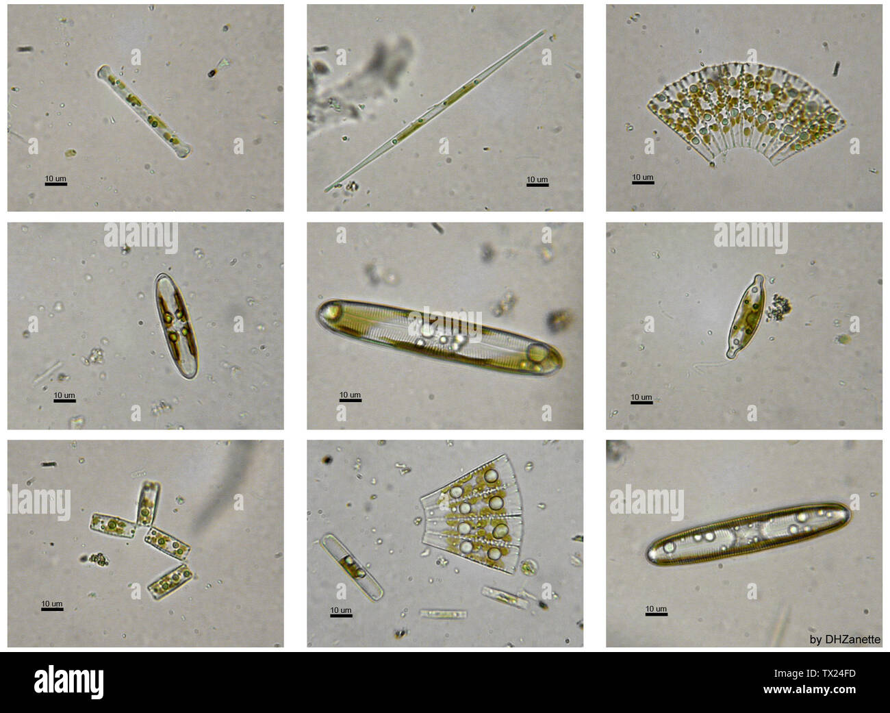 Diatoms and algae Banque de photographies et d’images à haute ...