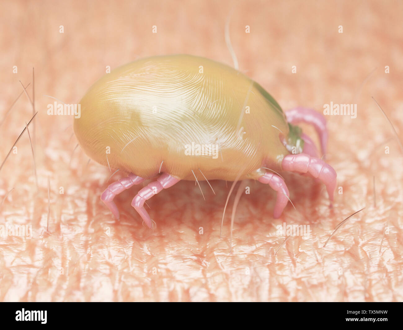 Allergie de la peau acarien Banque de photographies et d’images à haute ...