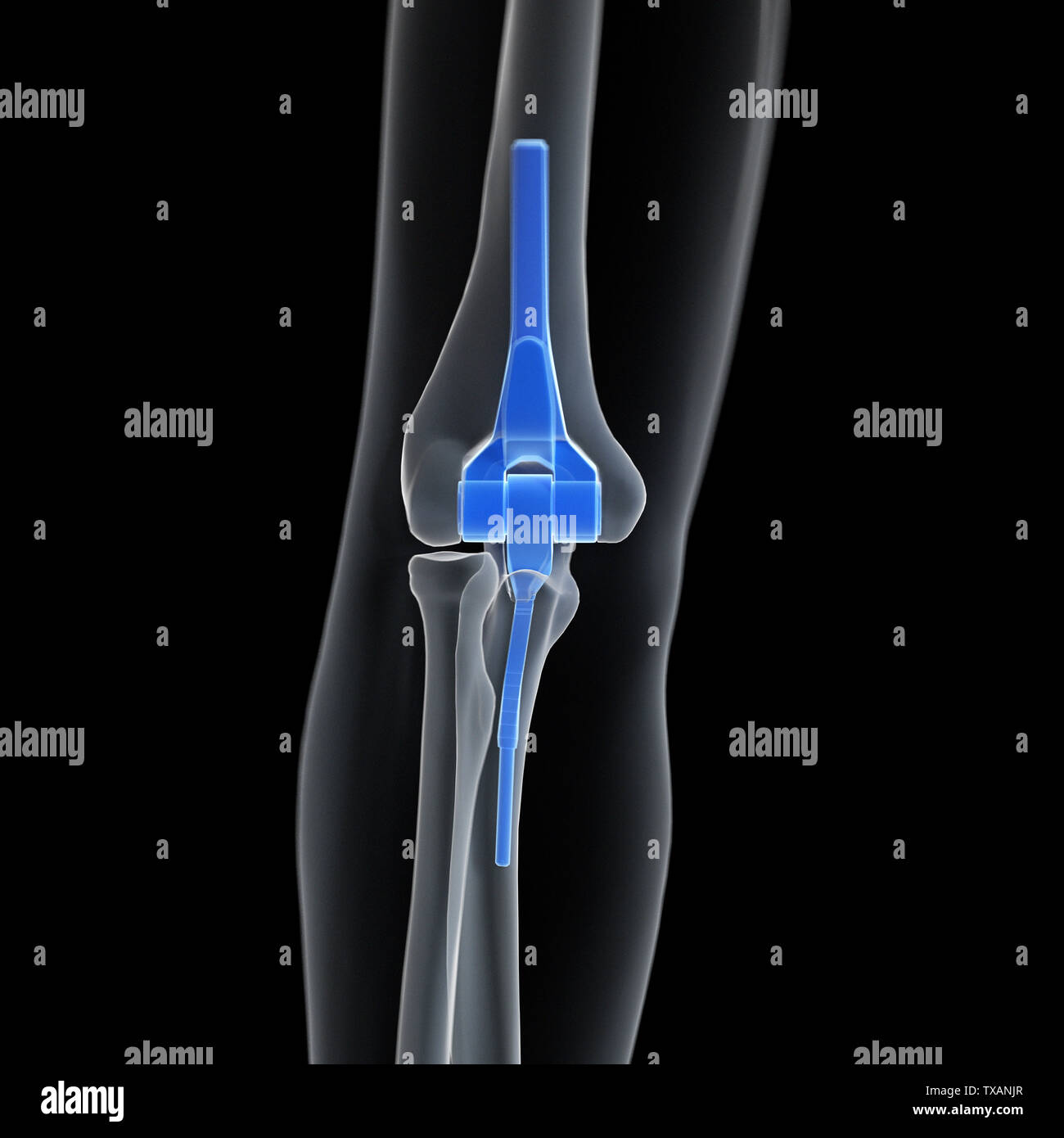 Anatomie du coude et cartilage Banque de photographies et d’images à ...