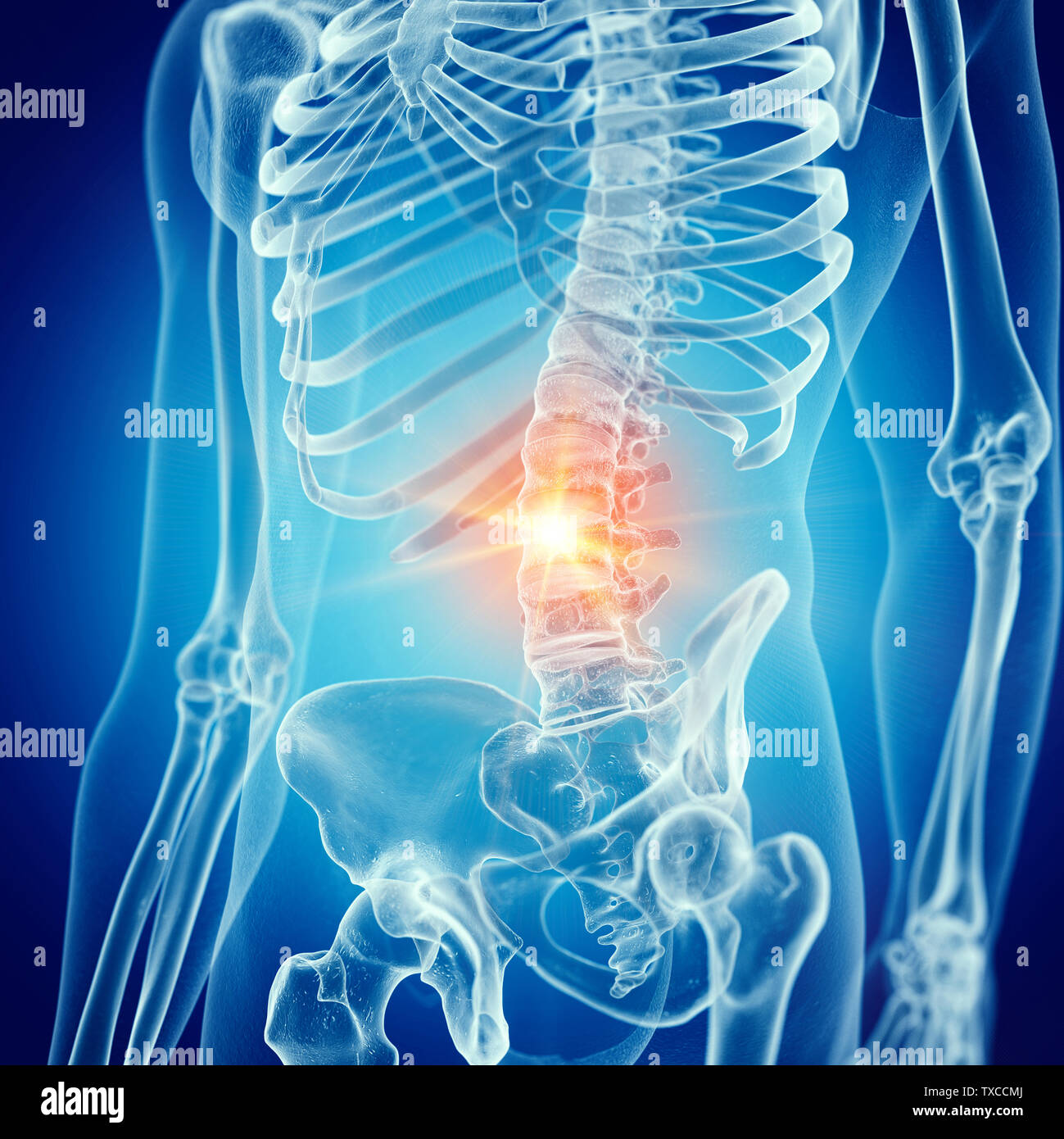 Lower back pain illustration Banque de photographies et d’images à ...