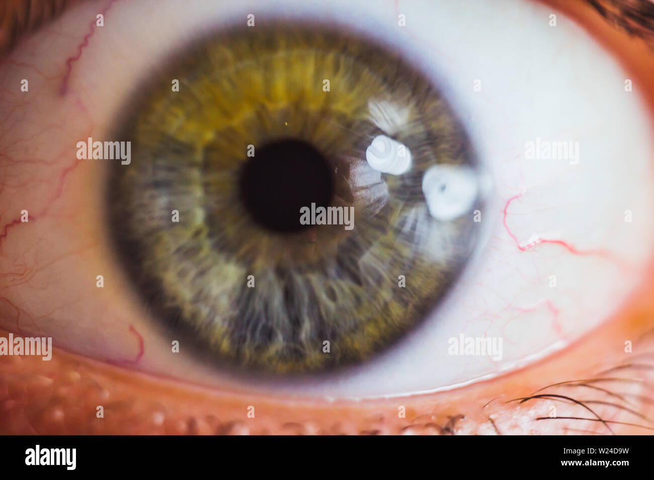 Œil injecté de sang yeux Banque de photographies et d’images à haute ...