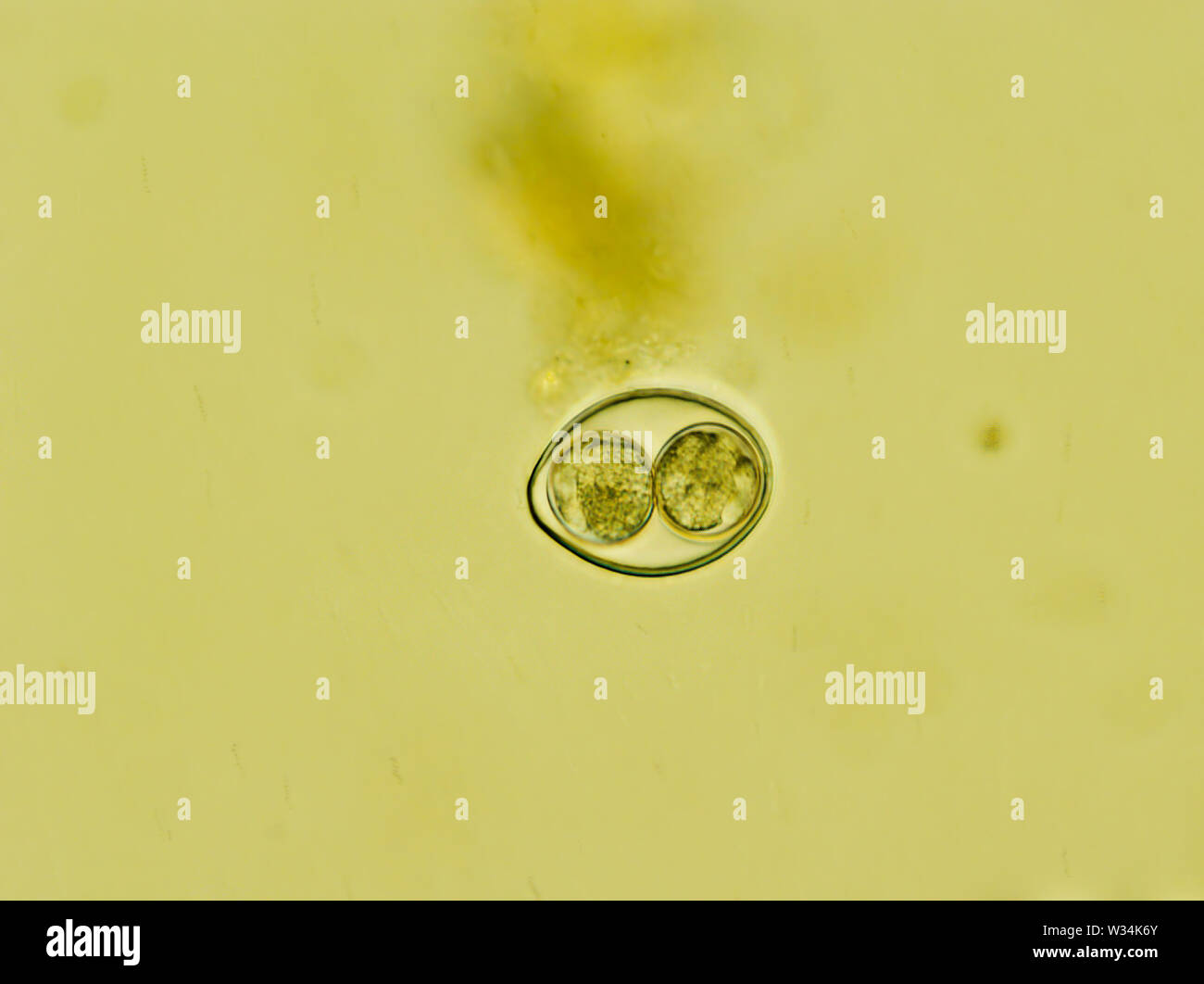 Isospora spp Banque de photographies et d’images à haute résolution - Alamy