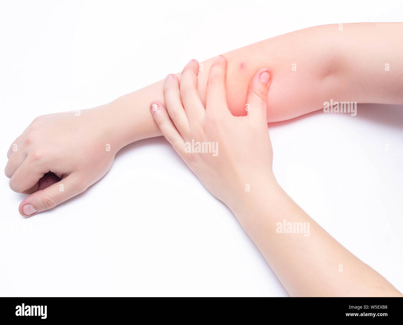 Gros bouton sur la peau Banque de photographies et d’images à haute ...