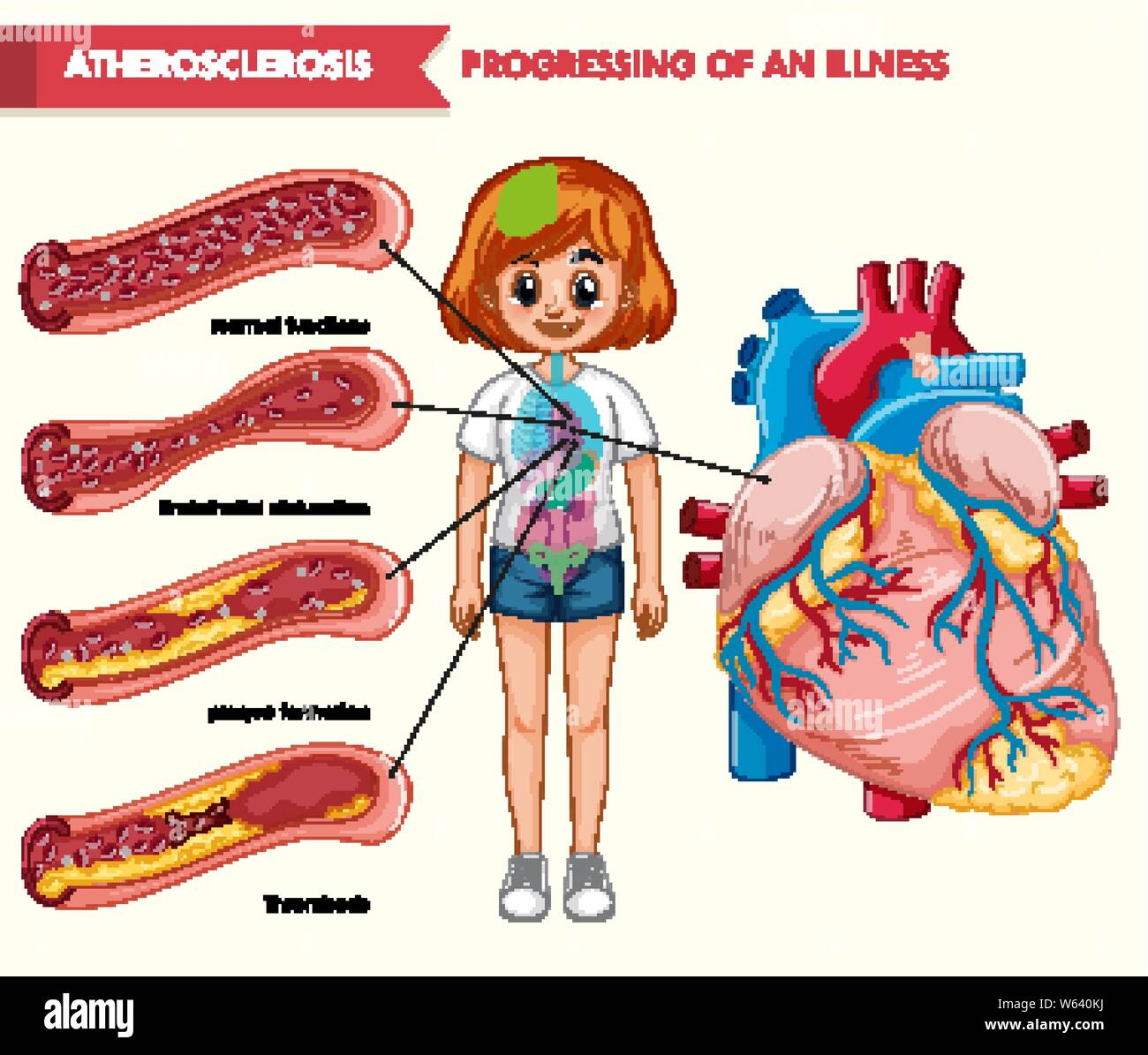 Plaque pédagogique Banque d'images vectorielles - Alamy