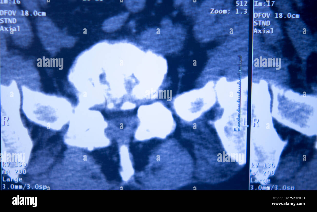 X-ray hôpital médical rachis bassin hanches traumatologie IRM scan ...