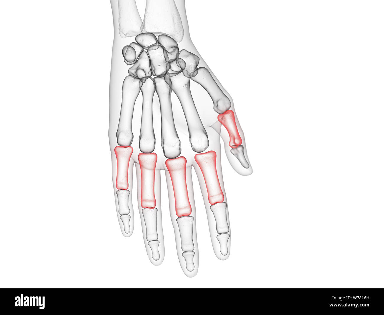 Phalanges Proximales Banque d'image et photos - Alamy