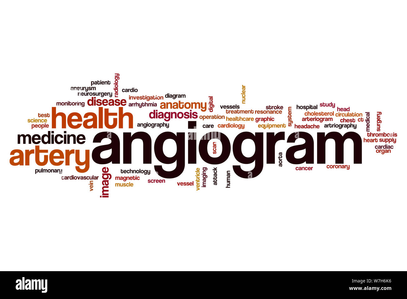 Angiogramme Pulmonaire Banque d'image et photos - Alamy