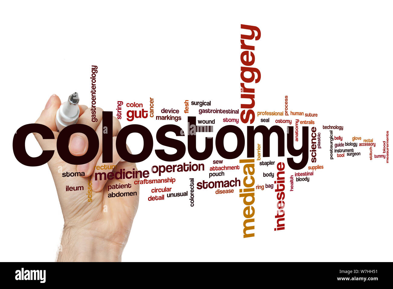 Colostomie stomie Banque de photographies et d’images à haute ...