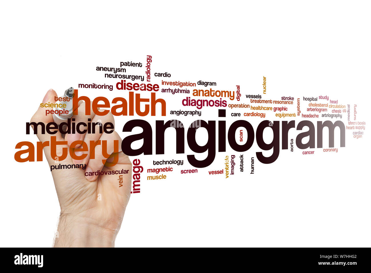 Angiogramme Pulmonaire Banque d'image et photos - Alamy