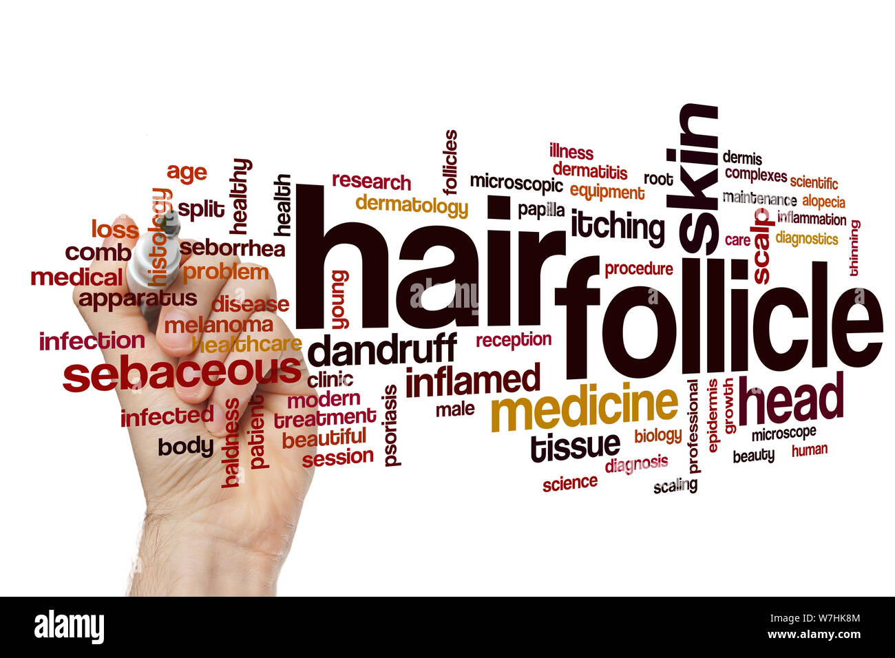 Inflammation des follicules pileux Banque de photographies et d’images ...