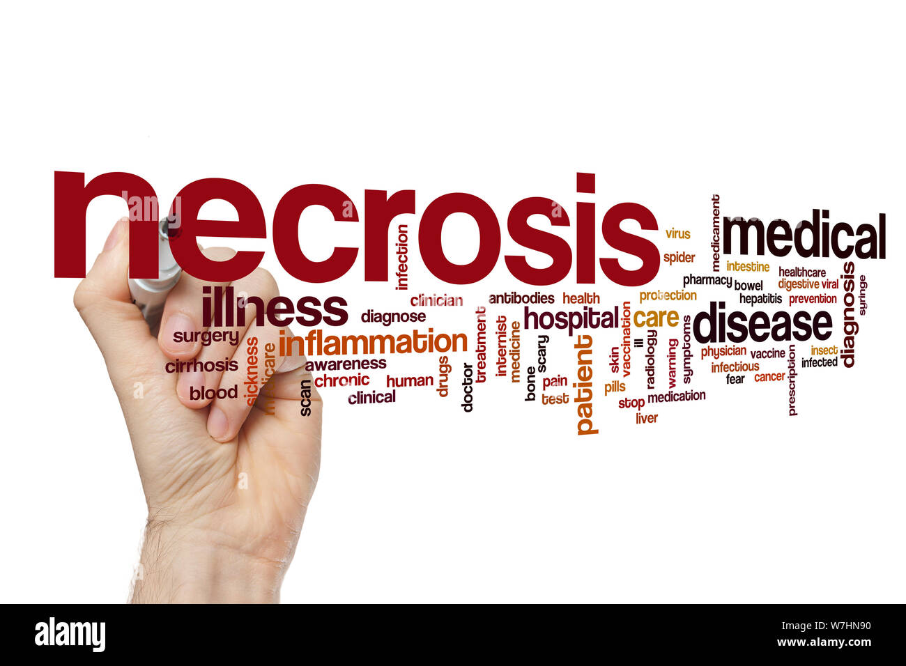 Nécrose cutanée Banque de photographies et d’images à haute résolution ...