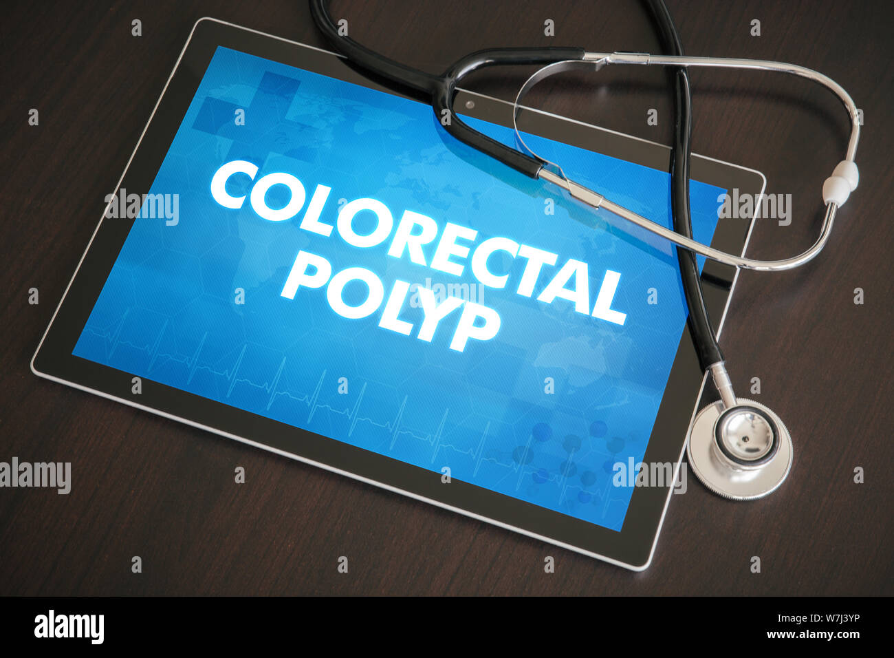 Polype sur le côlon Banque de photographies et d’images à haute ...