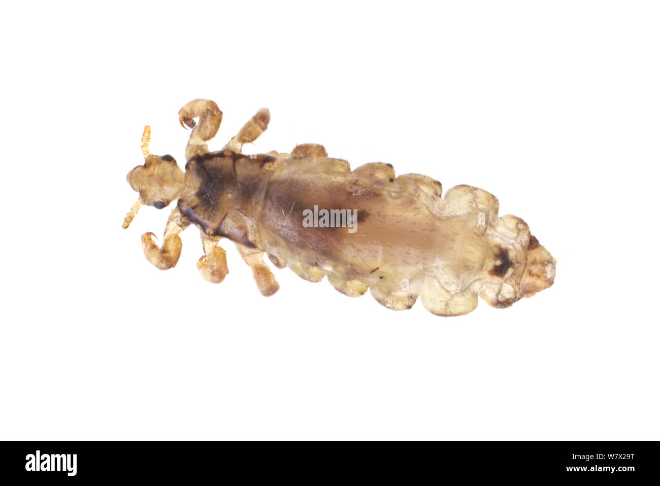 Pediculus humanus capitis Banque de photographies et d’images à haute ...