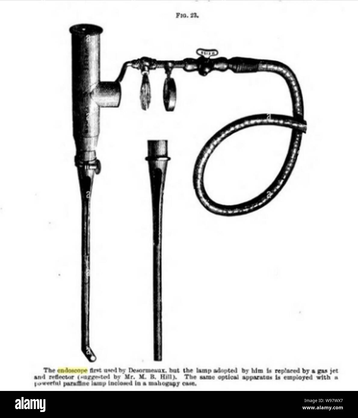 Desormeaux' dans endoscope Sir Henry Thompson's la pathologie et le ...