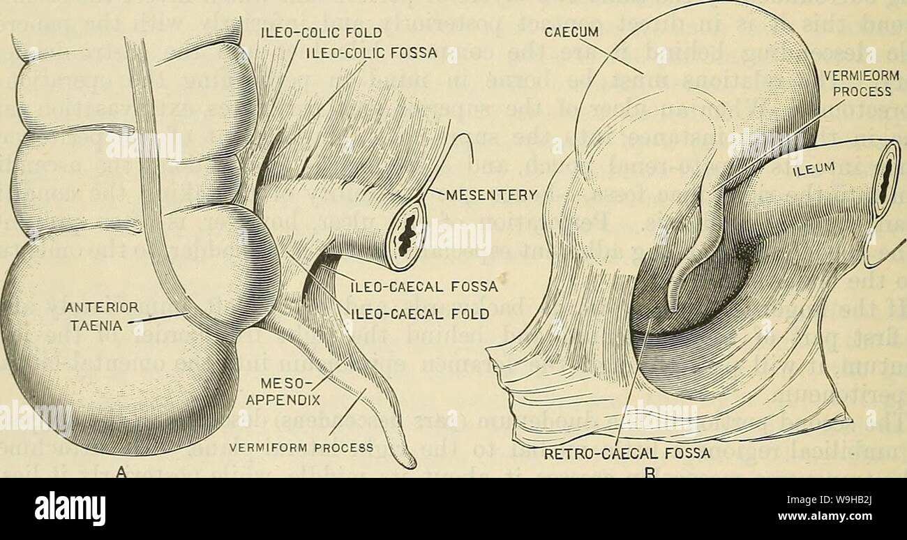 Hernie de la paroi abdominale Banque de photographies et d’images à ...