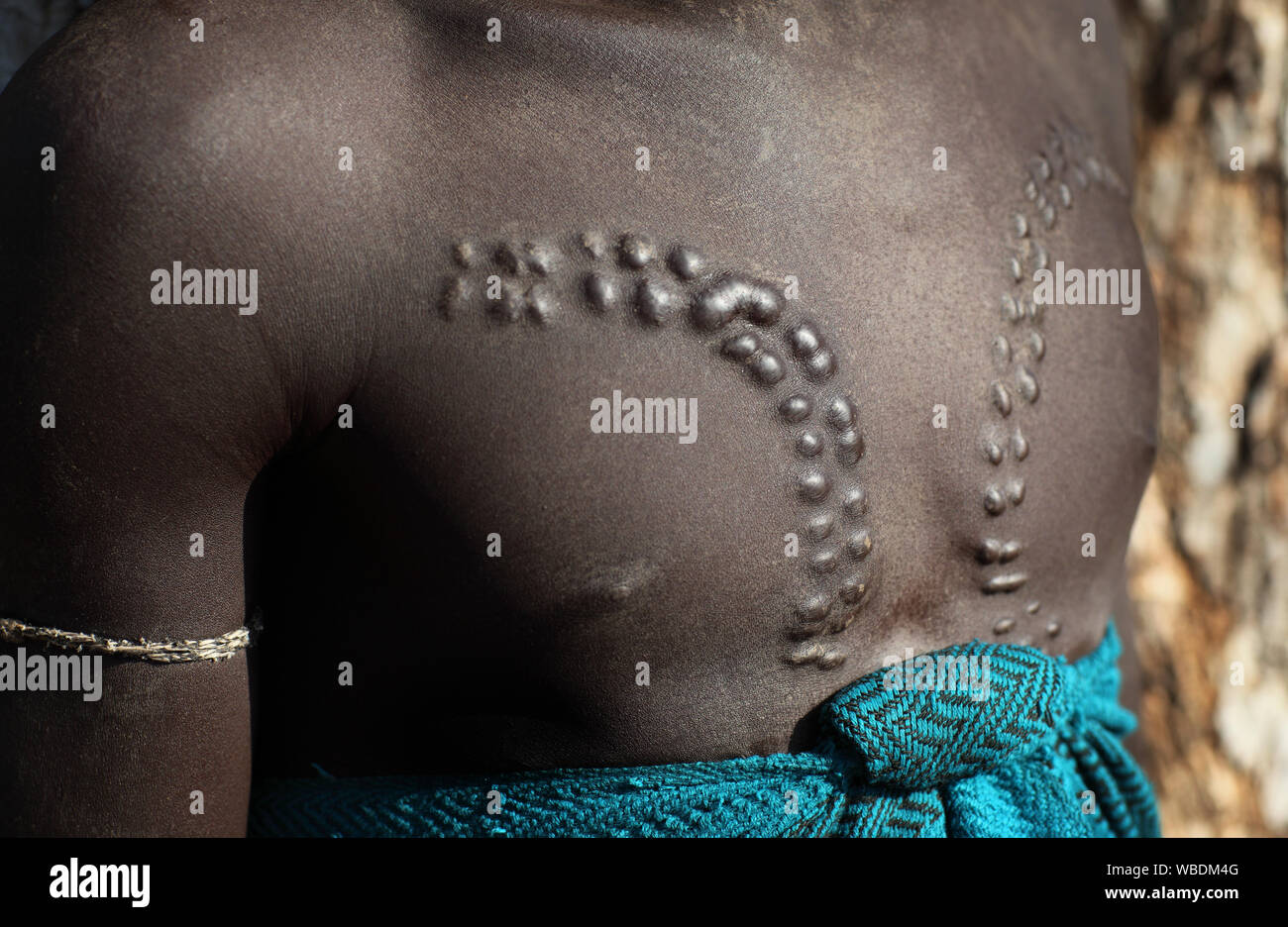 Scarification corporelle Banque de photographies et d’images à haute ...