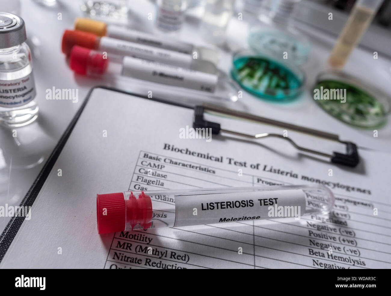 Vous analysez les échantillons de viande farcies contaminés par des ...