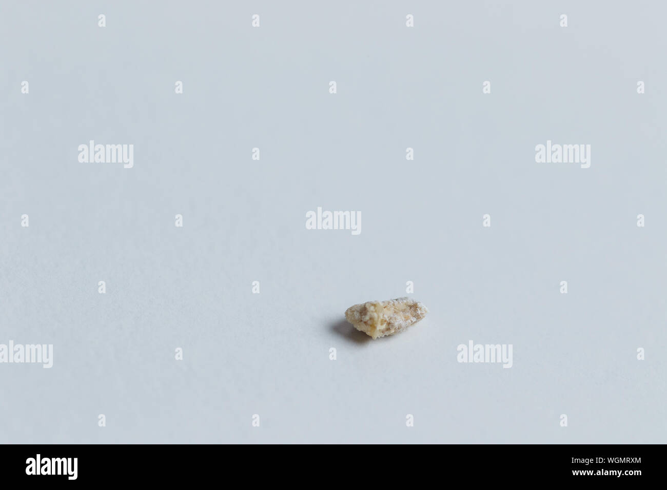 Pierres de rein Banque de photographies et d’images à haute résolution ...