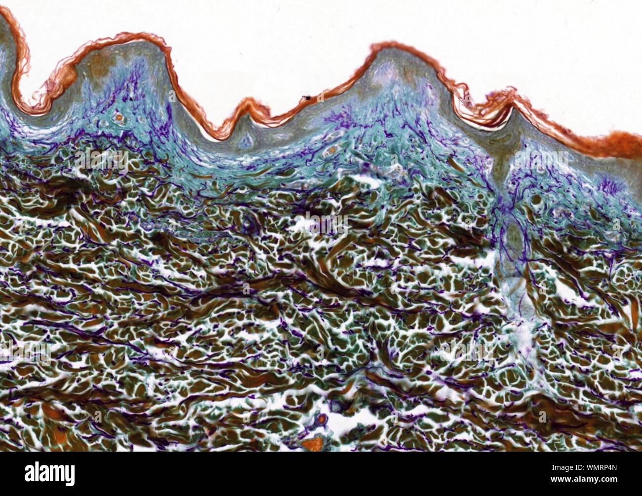 Schéma Glande Sébacée Humaine Banque d'image et photos - Alamy