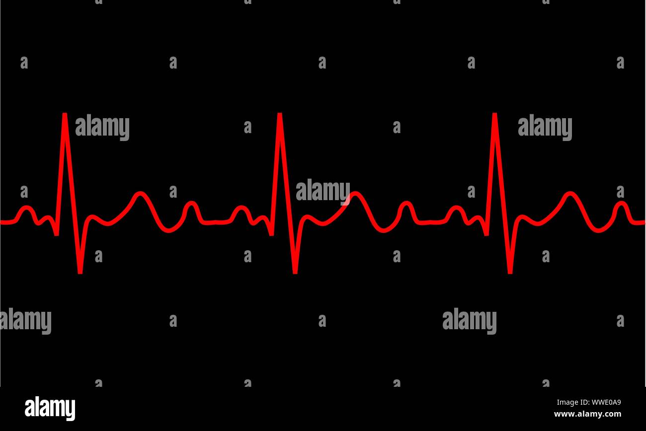 L'icône de pulsation. Pathologie ECG Trace, Vector illustration Image ...