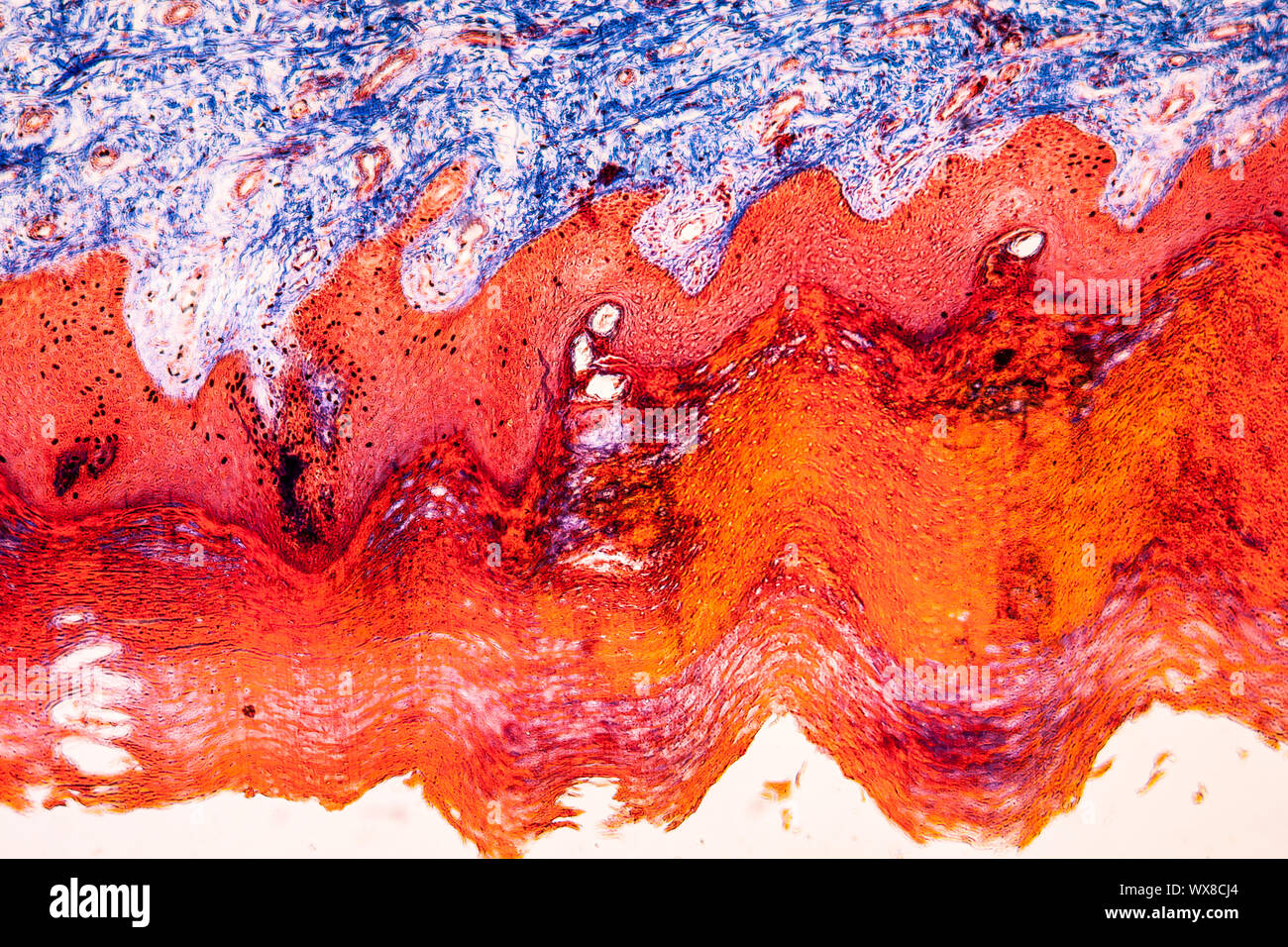 Granulation tissue Banque de photographies et d’images à haute ...