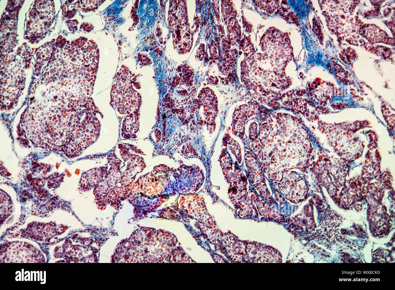 Basal cells Banque de photographies et d’images à haute résolution - Alamy