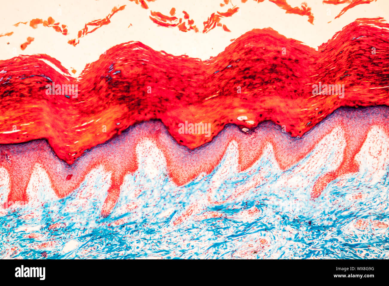 Pores de la peau microscope Banque de photographies et d’images à haute ...