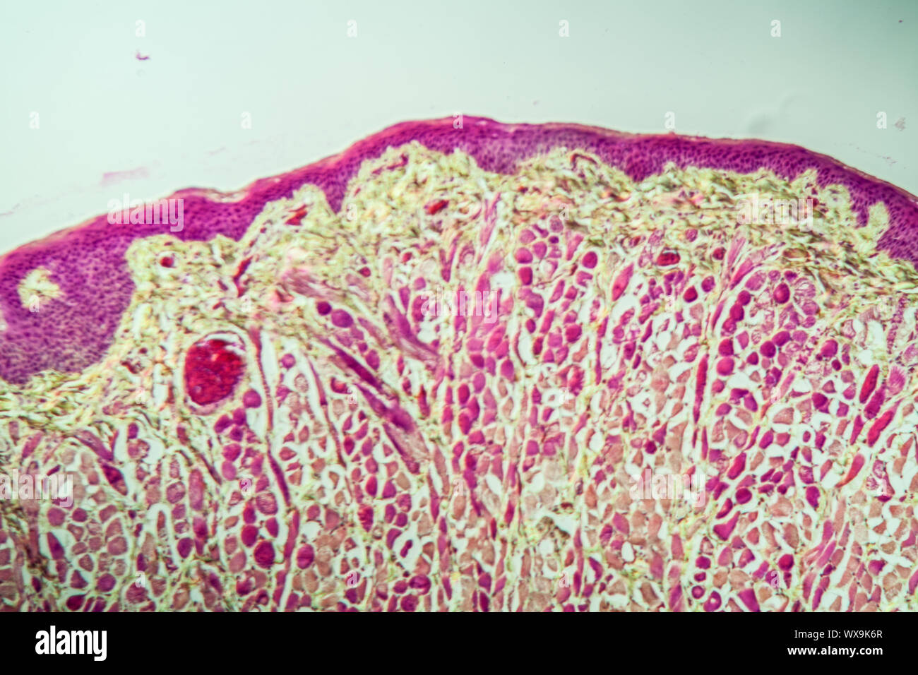 Papilles de la langue Banque de photographies et d’images à haute ...