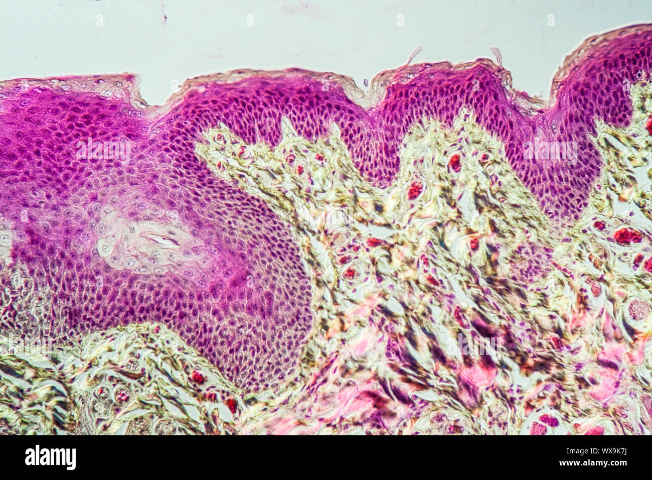 Papilles de la langue Banque de photographies et d’images à haute ...