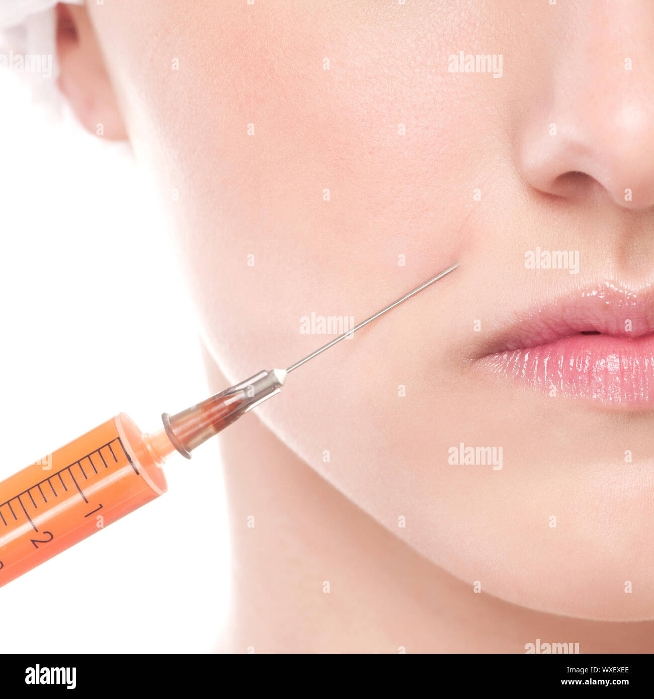 Injection de Botox Cosmétique dans le visage de femme. Lèvres et joues ...