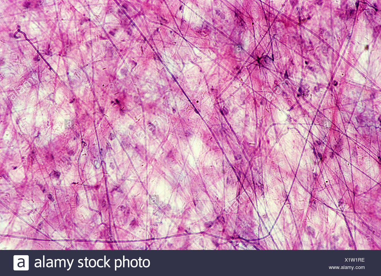 Les Fibres Du Collagene Banque d'image et photos - Alamy