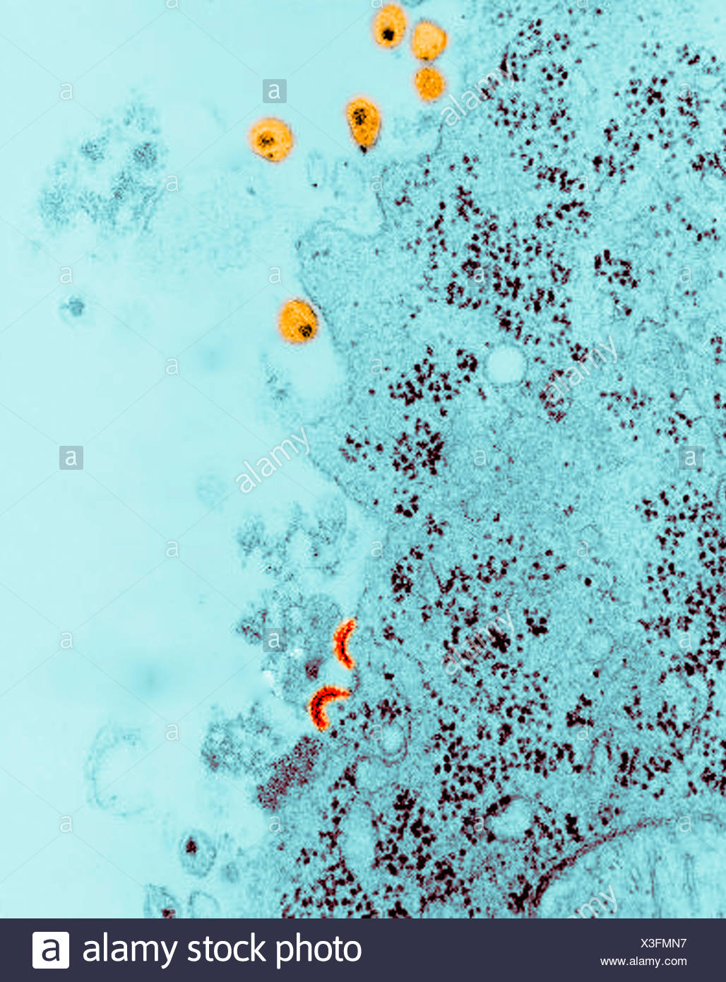 Sida Infection Par Le Virus Banque d'image et photos - Alamy