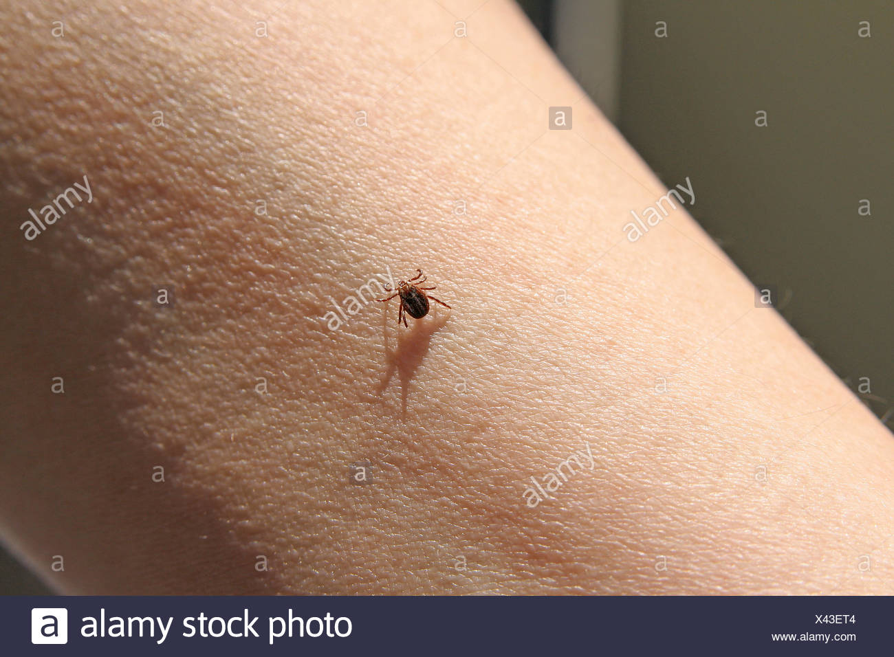 Morsure De Tique Banque d'image et photos - Alamy