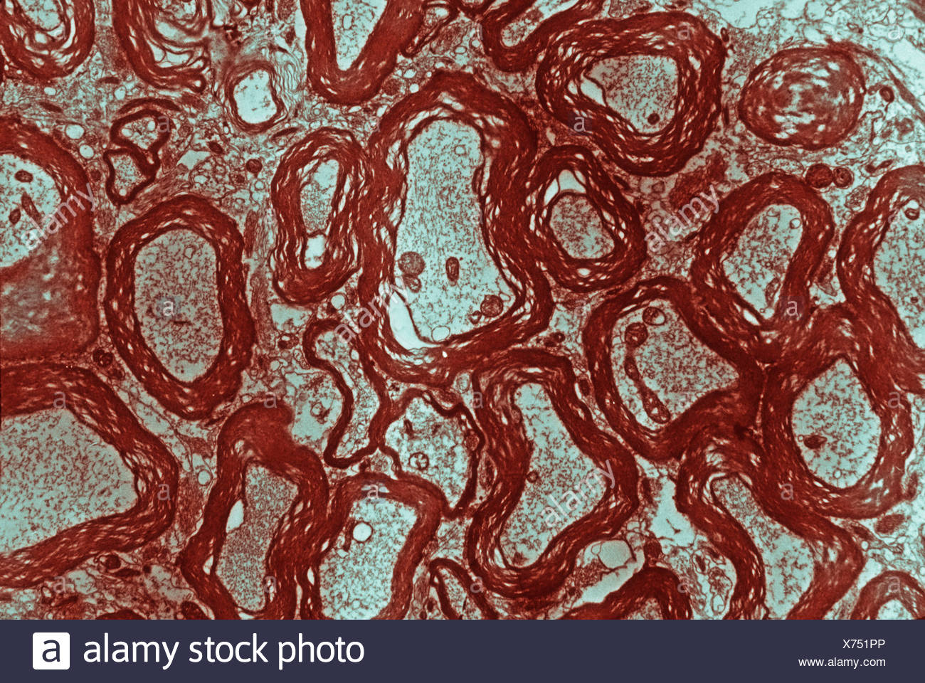 Nerf Optique Banque d'image et photos - Alamy