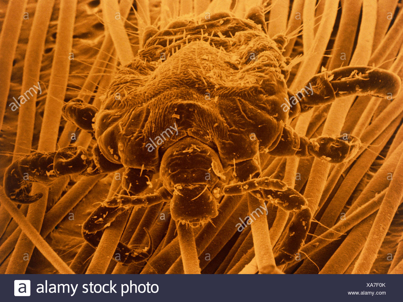 Poils Pubiens Banque d'image et photos - Alamy