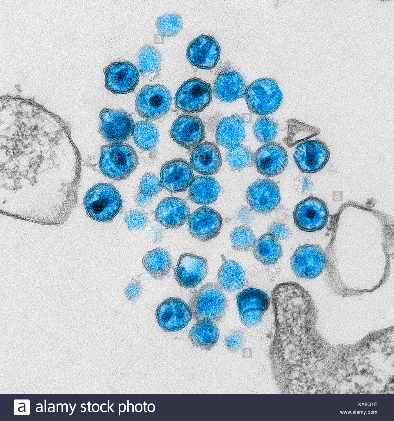 Sida Infection Par Le Virus Banque d'image et photos - Alamy