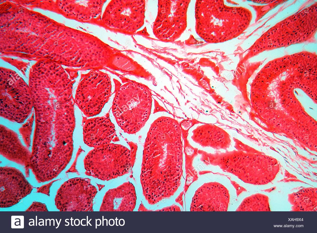 Testicule Humain Banque d'image et photos - Alamy
