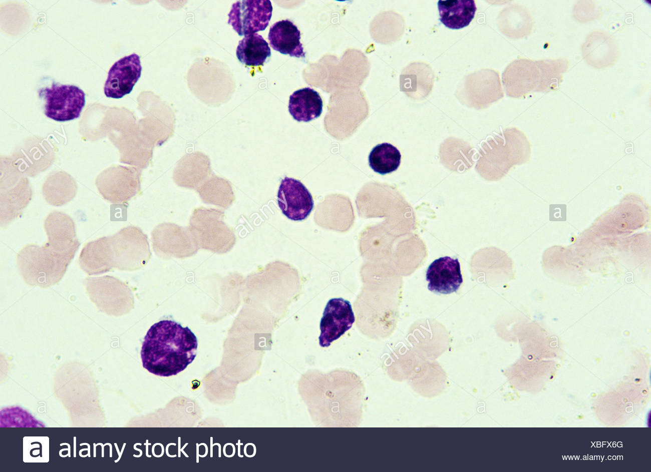 Plaquettes De Globules Rouges Humains Banque d'image et photos - Alamy
