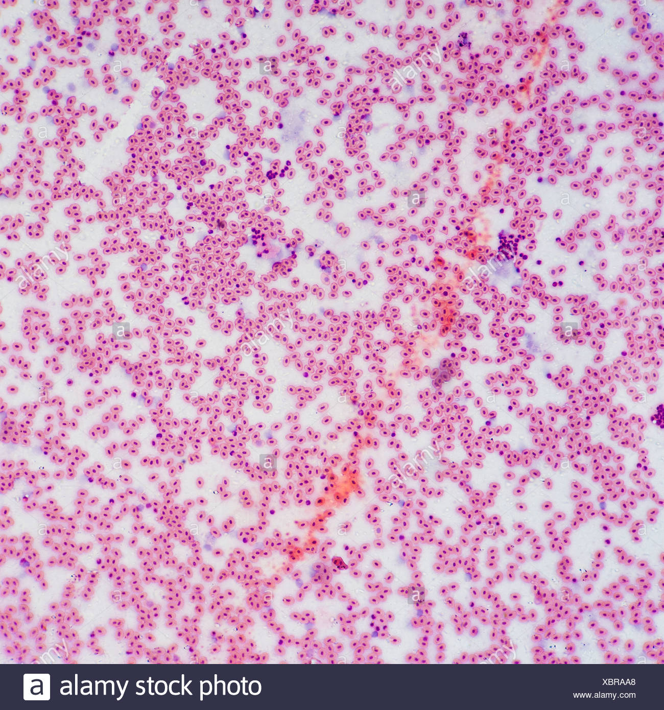 Blood Smear Micrograph Banque d'image et photos - Alamy