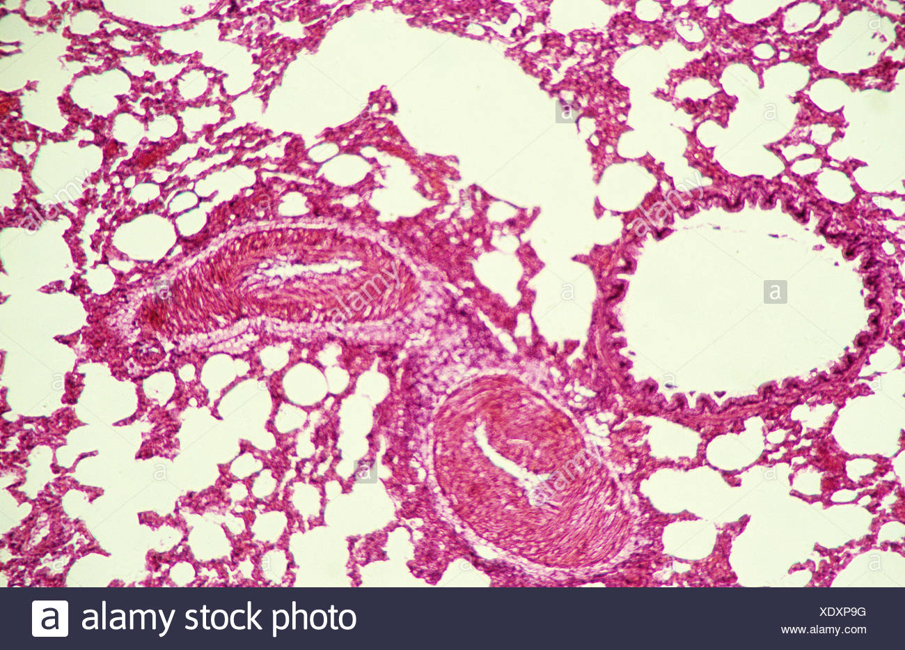 Lung Bronchiole Alveoli Banque d'image et photos - Alamy