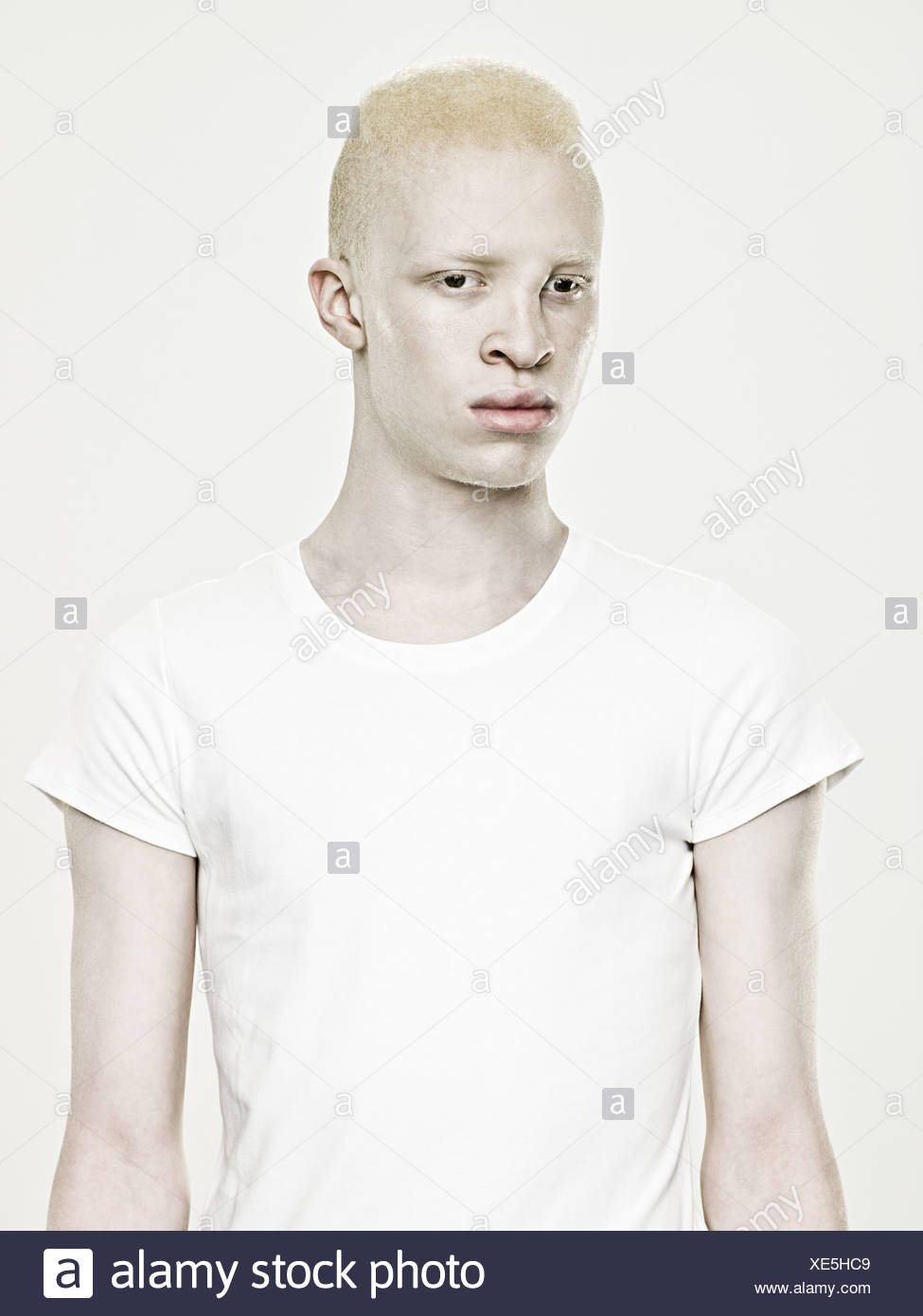 Albino Man Photos & Albino Man Images - Alamy