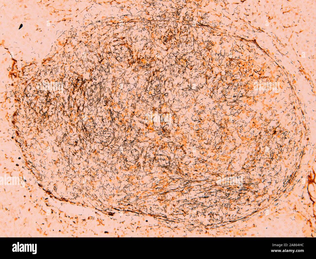 Inguinal anatomy immagini e fotografie stock ad alta risoluzione - Alamy