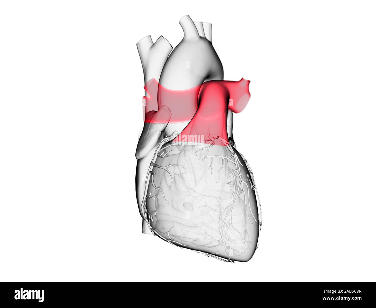 Tronco polmonare immagini e fotografie stock ad alta risoluzione - Alamy